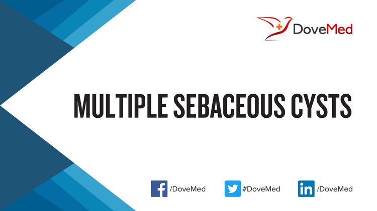 Multiple Sebaceous Cysts