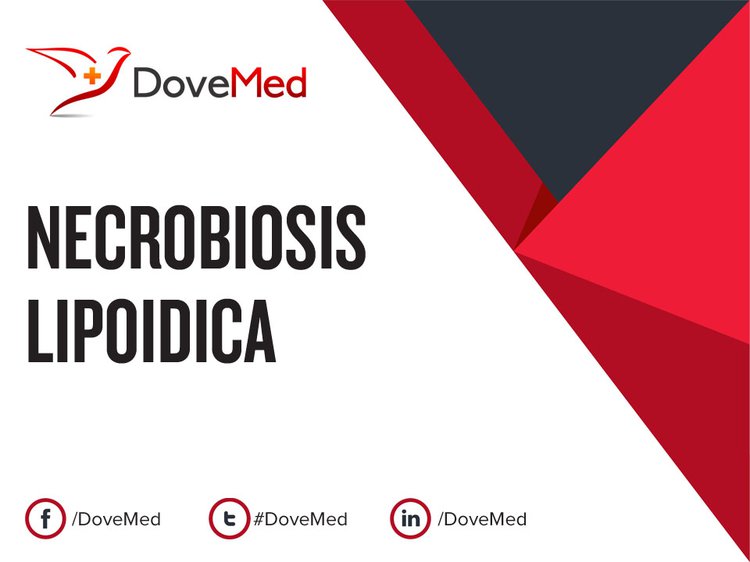 Necrobiosis Lipoidica