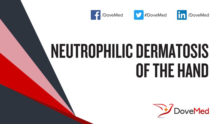 Neutrophilic Dermatosis of the Hand