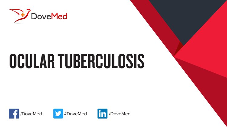 Ocular Tuberculosis