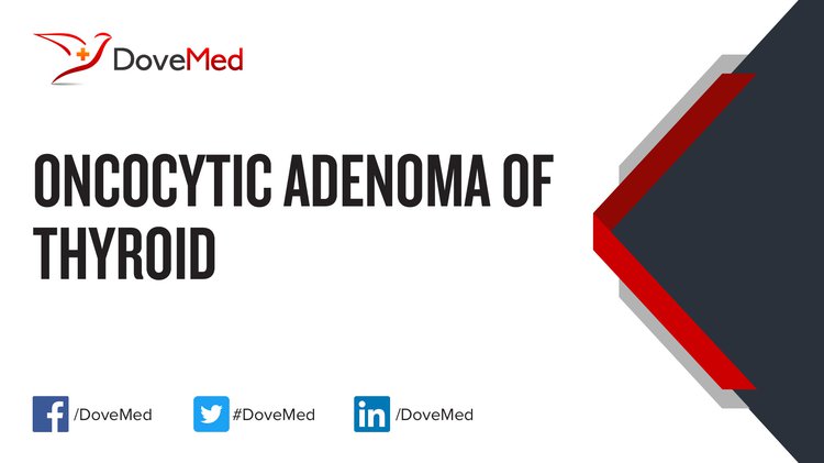 Oncocytic Adenoma Of Thyroid