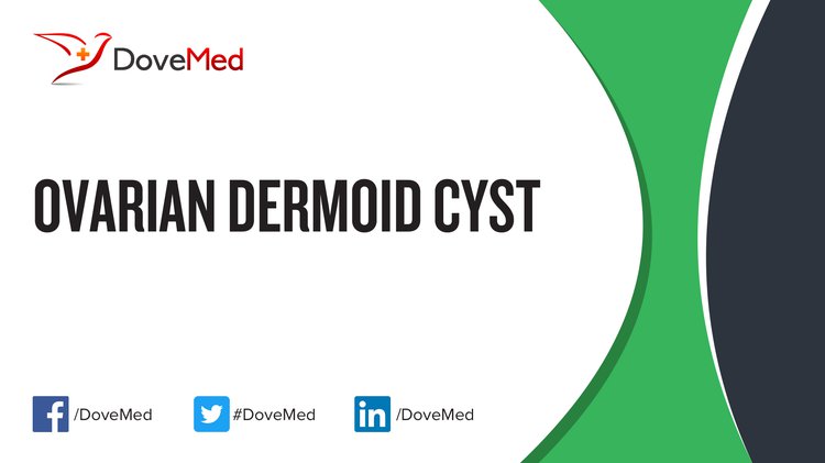 Ovarian Dermoid Cyst