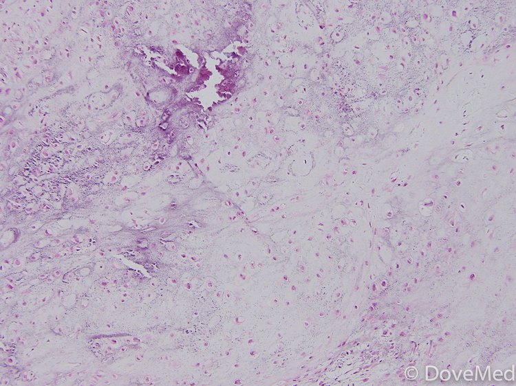 Subcutaneous Tissue Slide