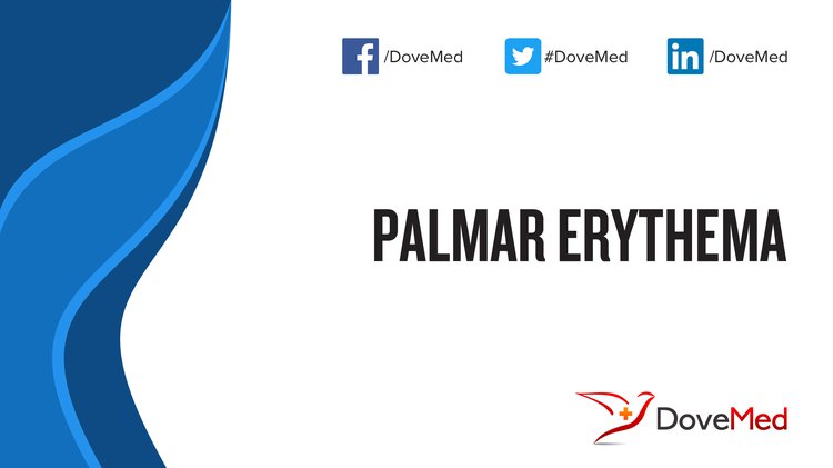 Palmar Erythema