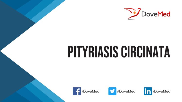 Pityriasis Circinata