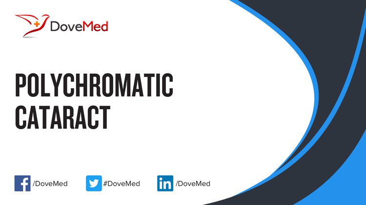 Polychromatic Cataract