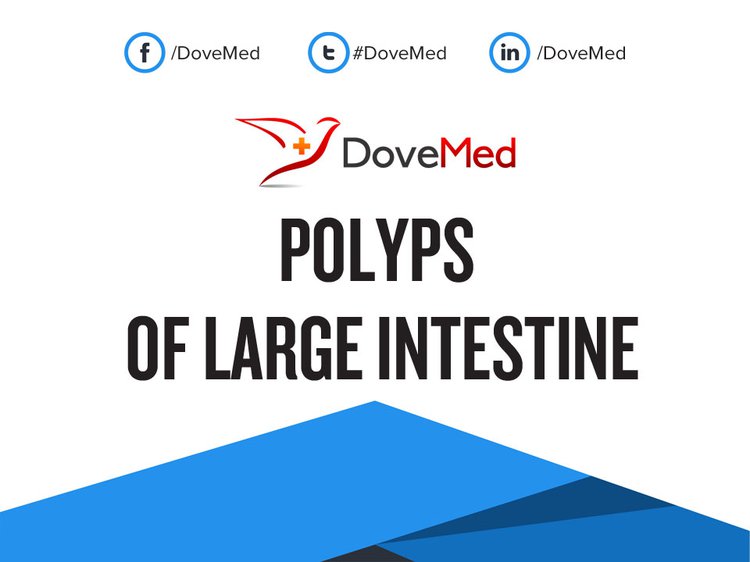 Polyps of Large Intestine
