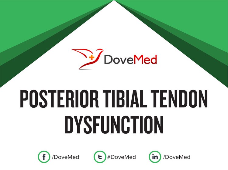 Posterior Tibial Tendon Dysfunction