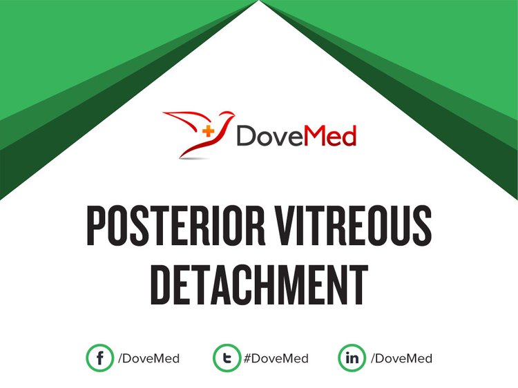 Posterior Vitreous Detachment