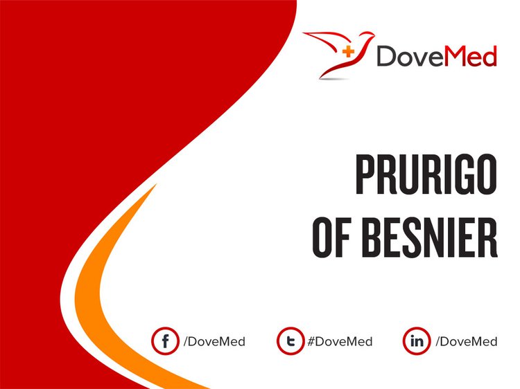 Prurigo of Besnier