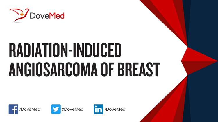 Radiation-Induced Angiosarcoma of Breast