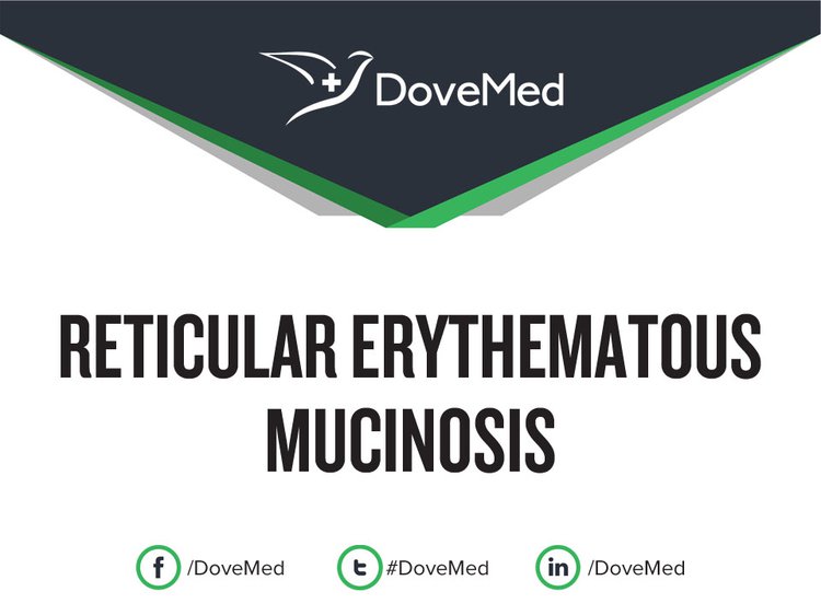 Reticular Erythematous Mucinosis
