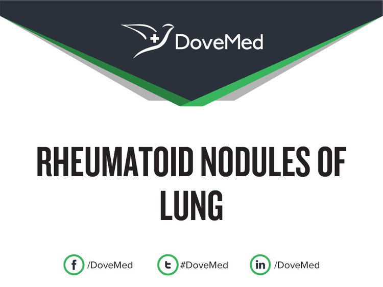Rheumatoid Nodules Of Lung