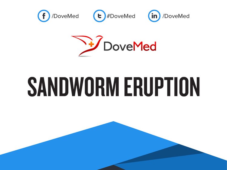 Sandworm Eruption
