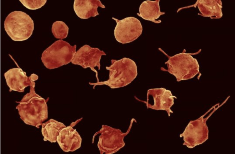 Video Of Blood Clot Contraction Reveals How Platelets Naturally Form ...