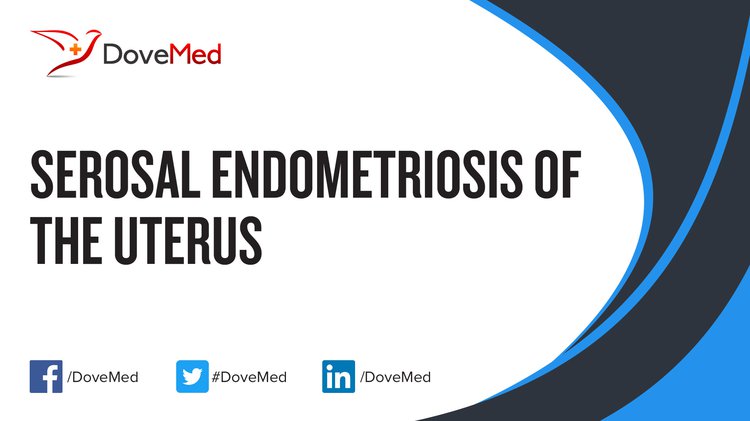 Serosal Endometriosis of the Uterus