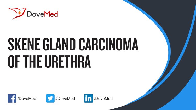 Skene Gland Carcinoma of the Urethra