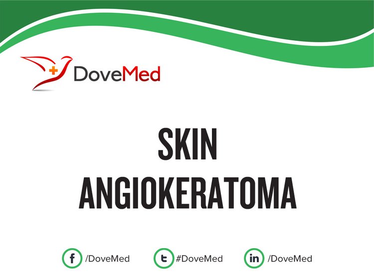 Skin Angiokeratoma