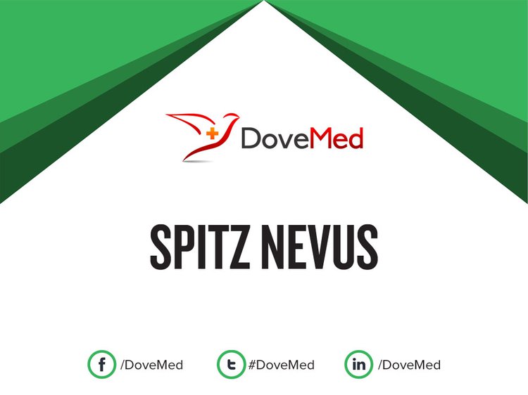 Spitz Nevus