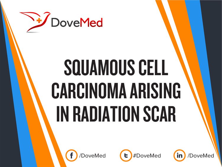 Squamous Cell Carcinoma arising in Radiation Scar
