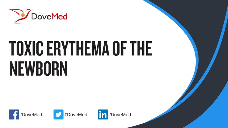 Toxic Erythema of the Newborn
