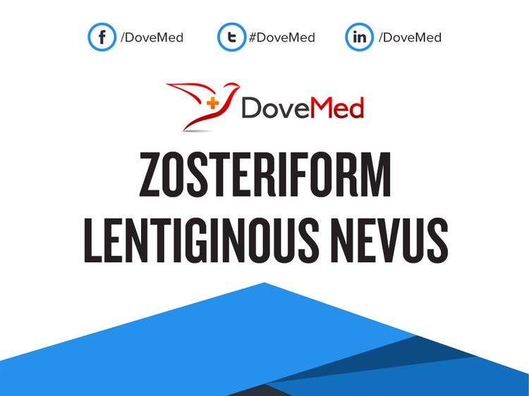 Zosteriform Lentiginous Nevus