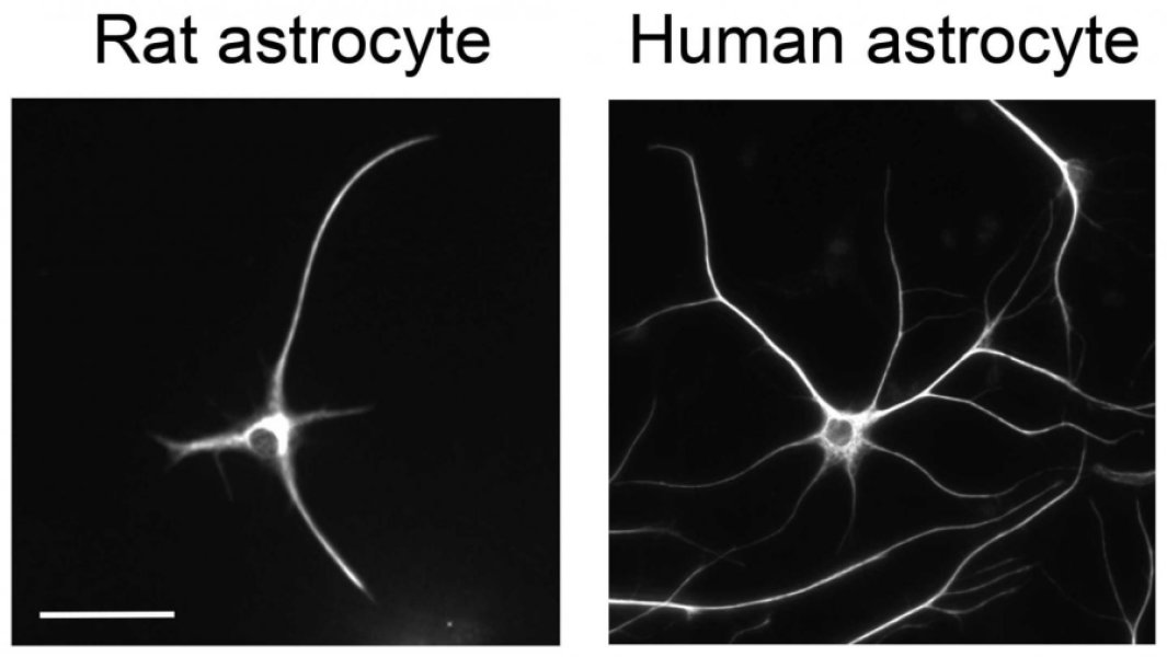 Brain Function: First Look At How Astrocytes Function In Humans
