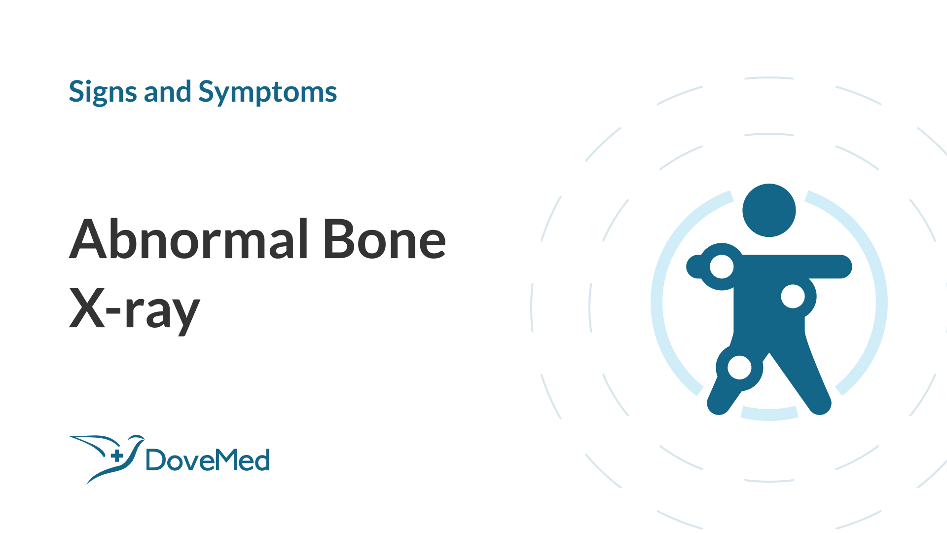 Abnormal Bone X-ray