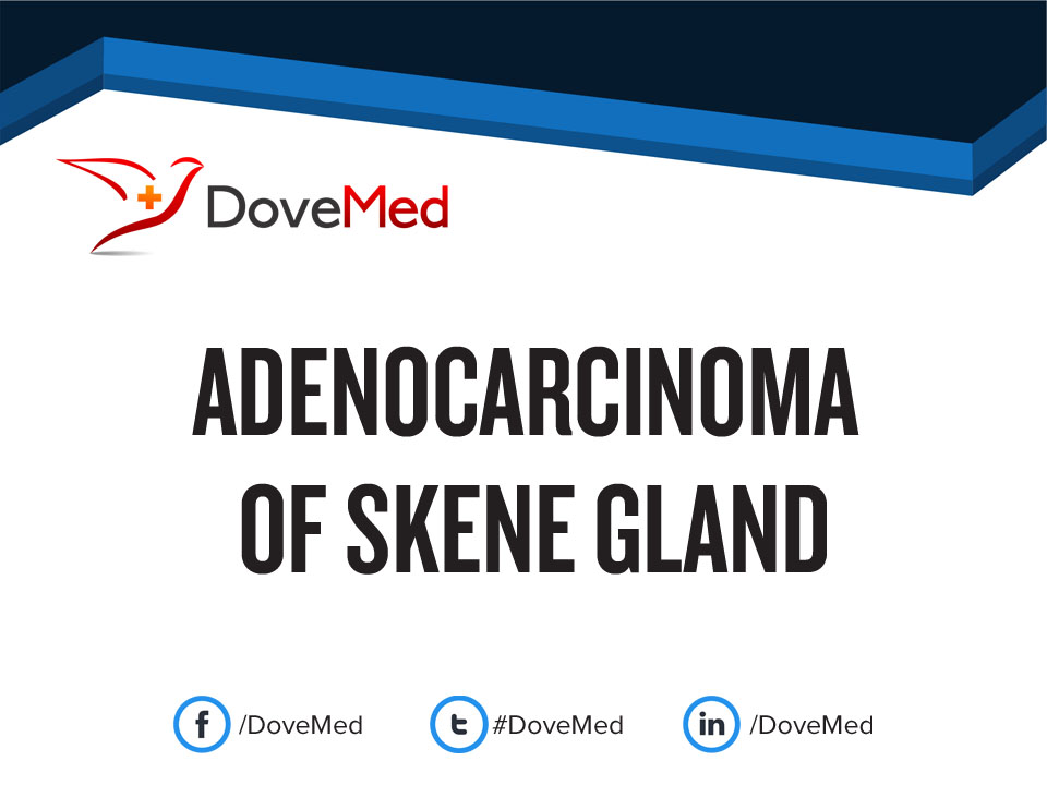 Skene Gland