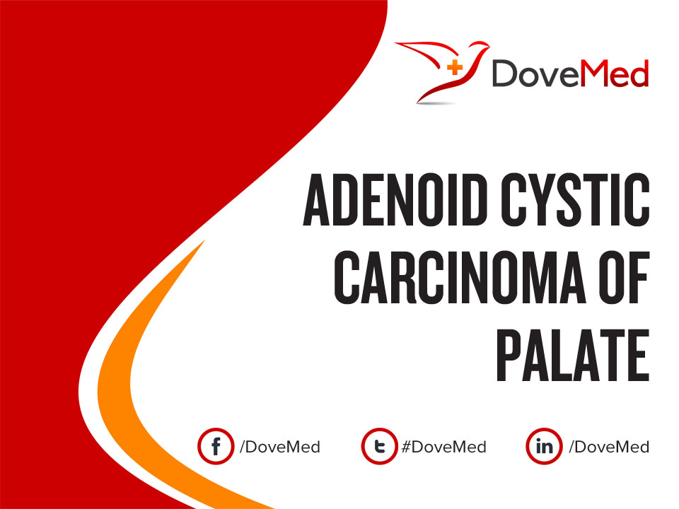 Adenoid Cystic Carcinoma Of Palate