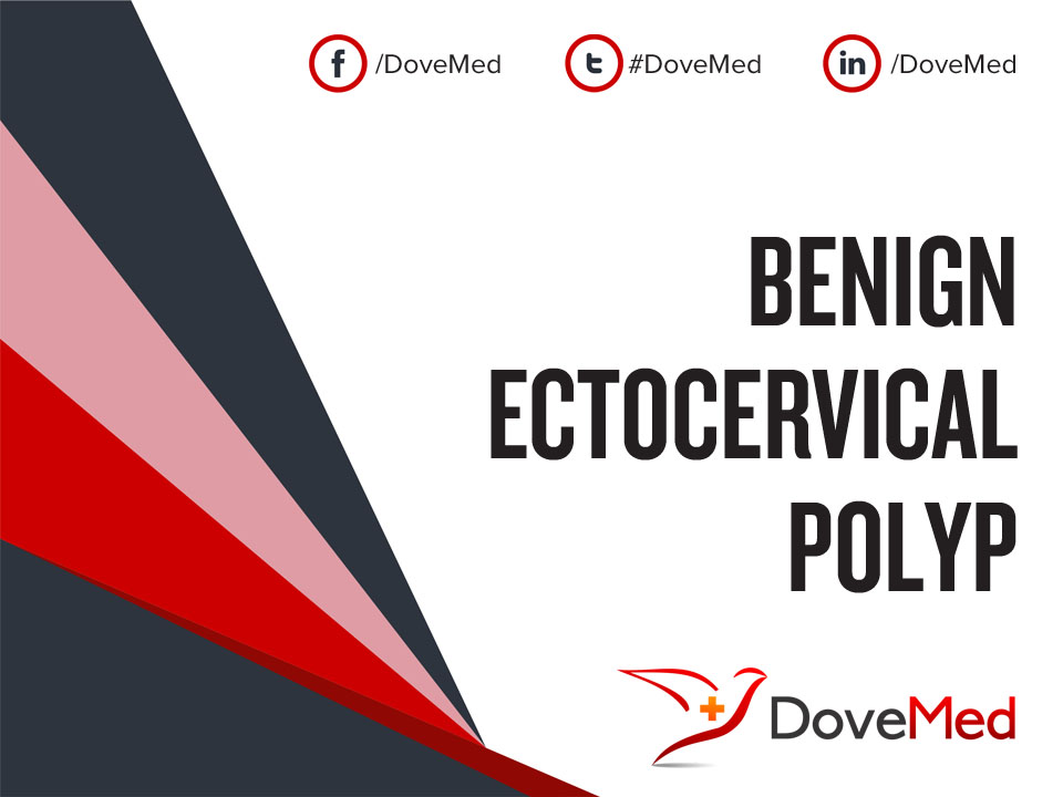Benign Ectocervical Polyp