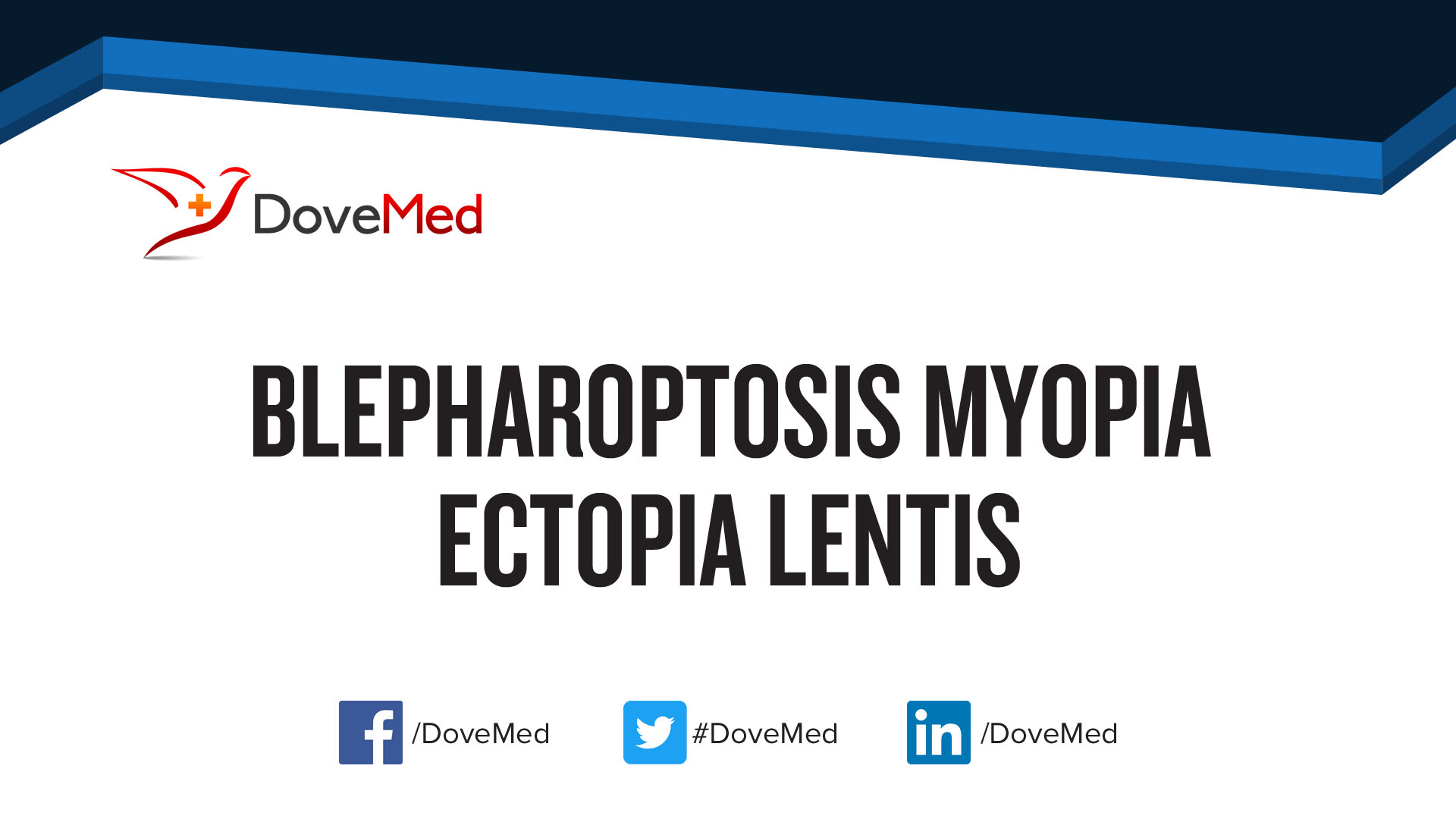 Blepharoptosis Myopia Ectopia Lentis