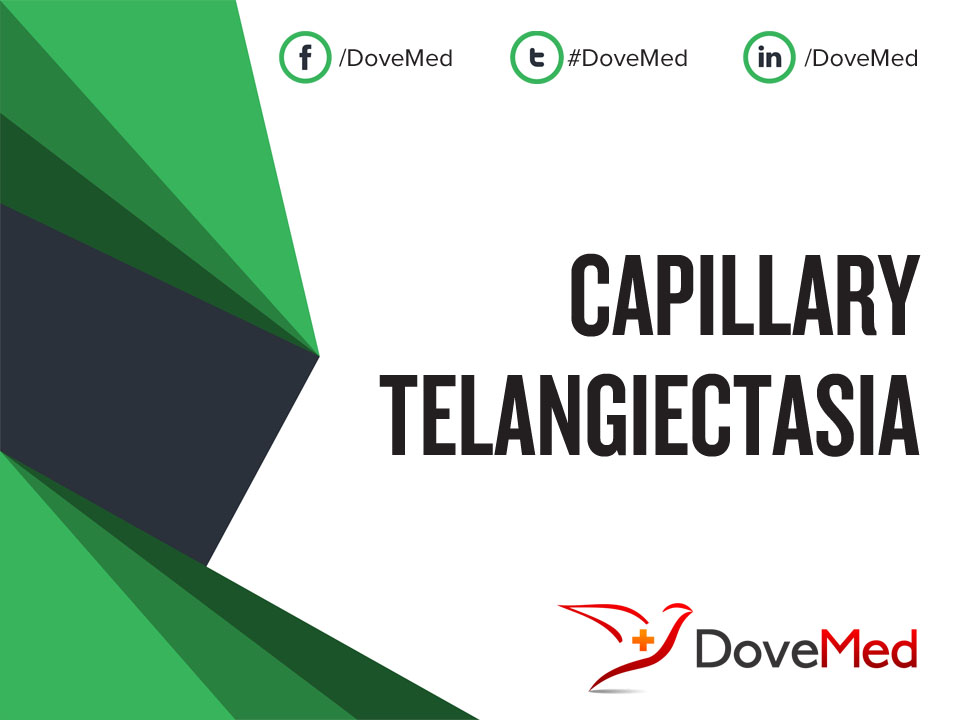 Capillary Telangiectasia