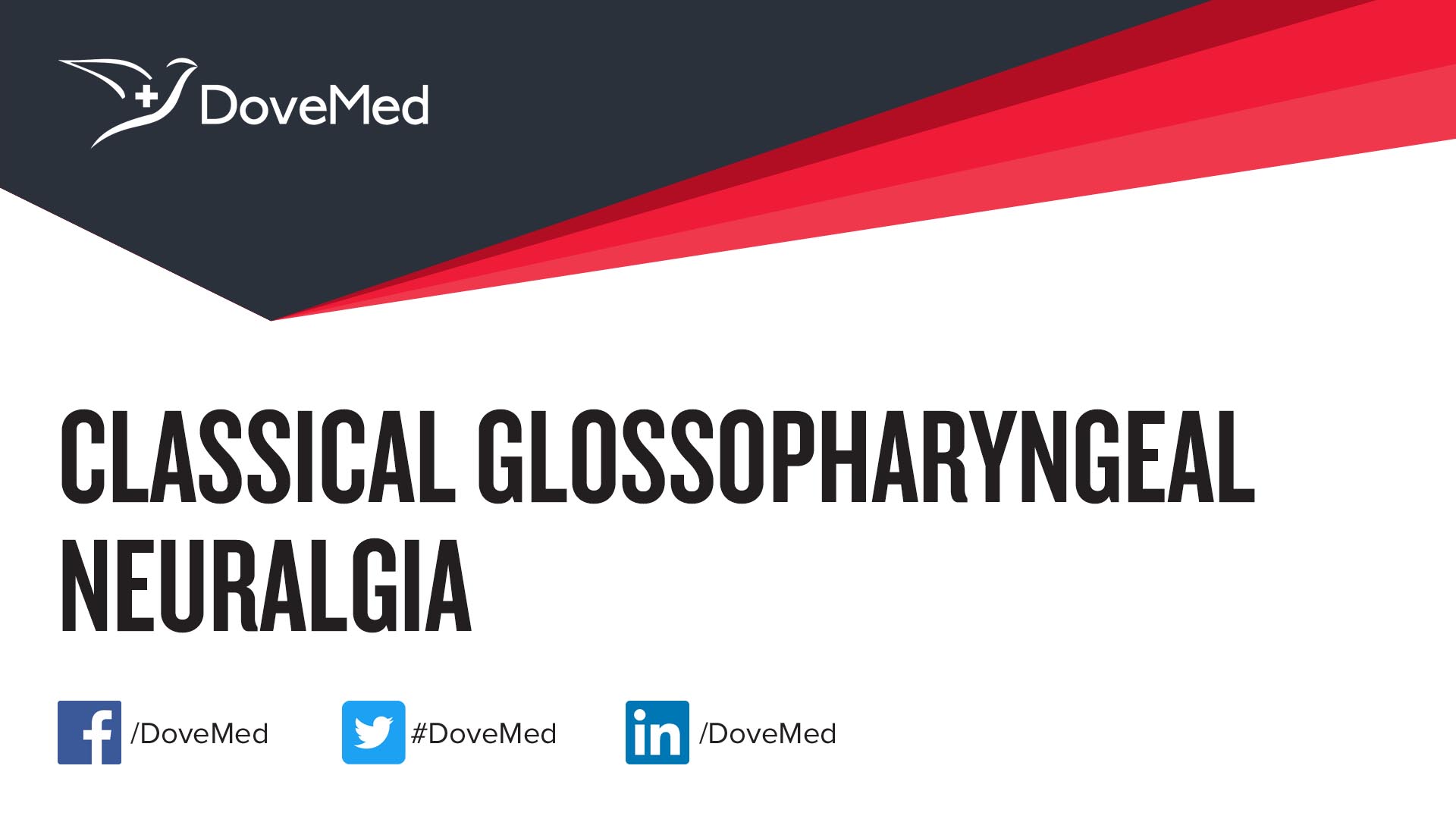 Classical Glossopharyngeal Neuralgia