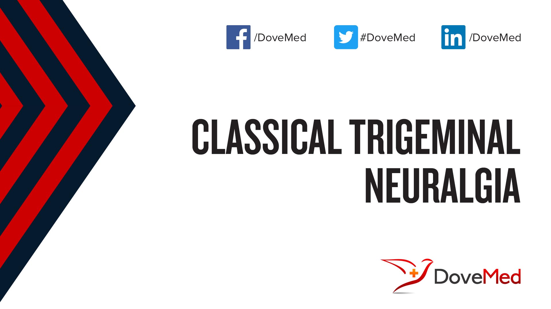 Classical Trigeminal Neuralgia