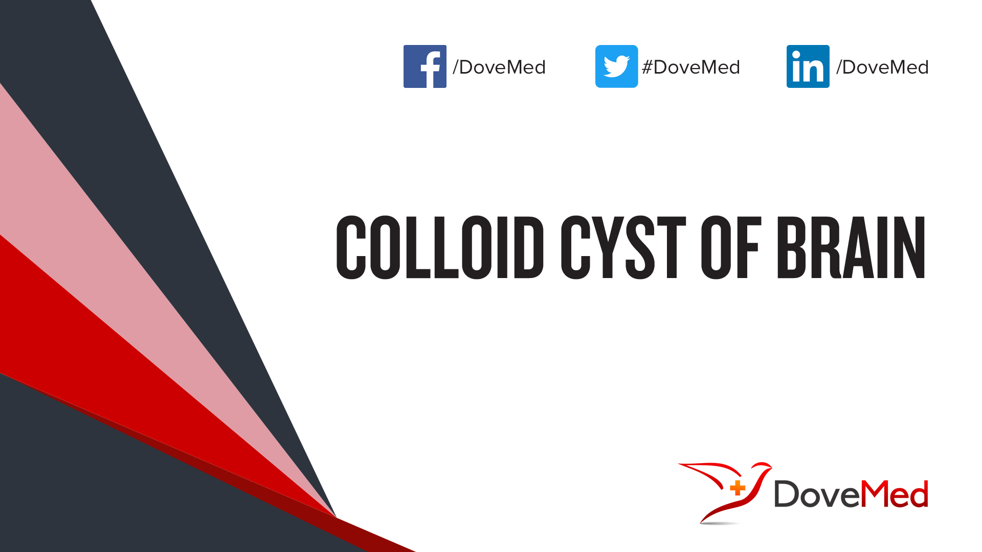 Colloid Cyst Of Brain