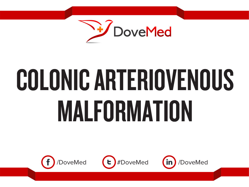 Colonic Arteriovenous Malformation