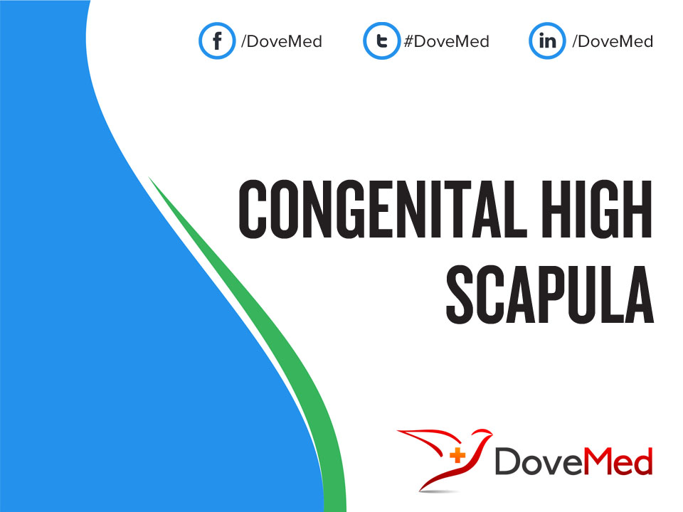 Congenital High Scapula