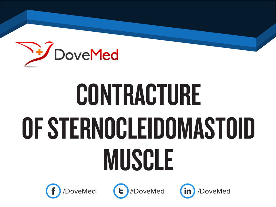 Contracture of Sternocleidomastoid Muscle