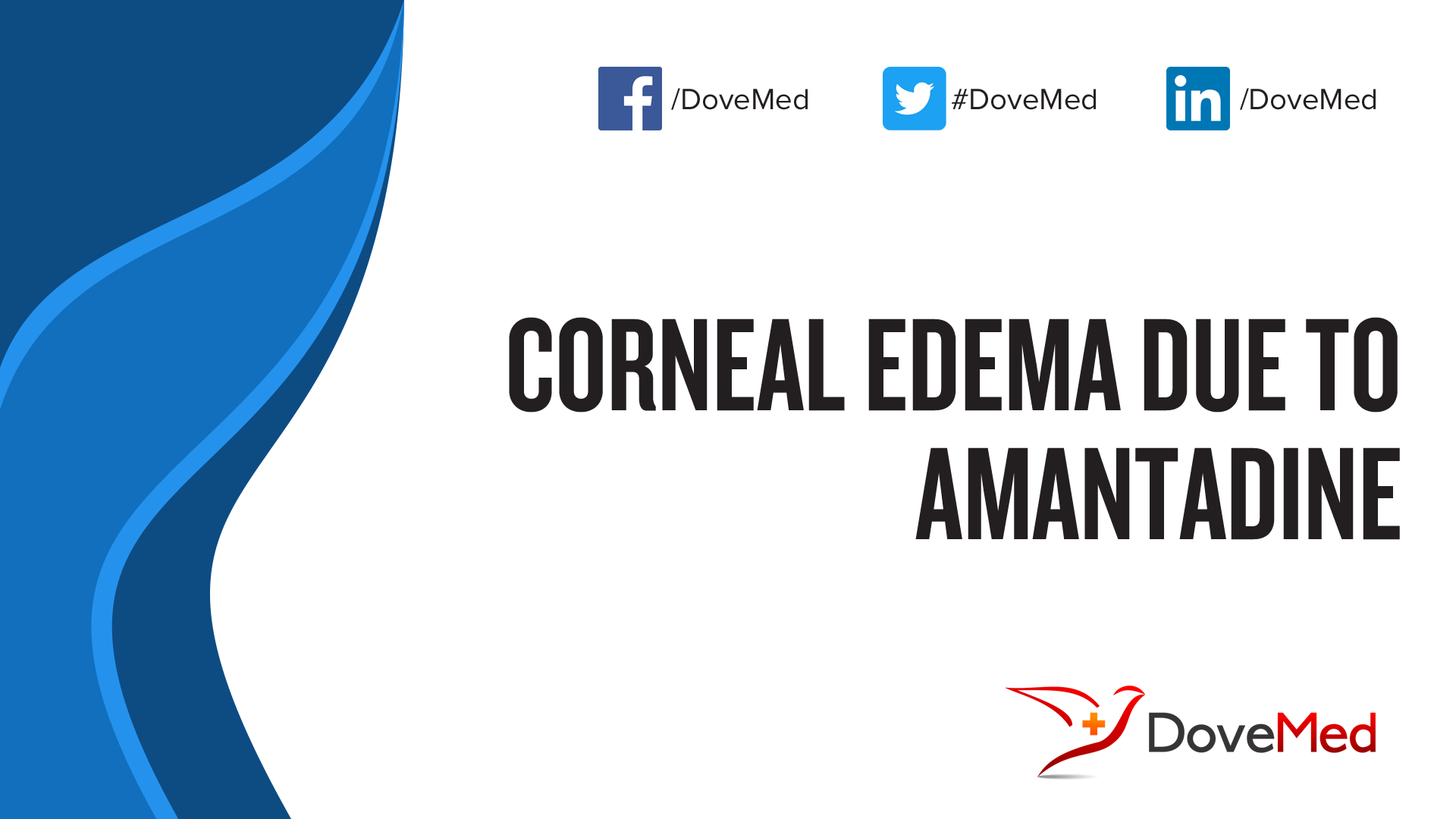 Corneal Edema due to Amantadine