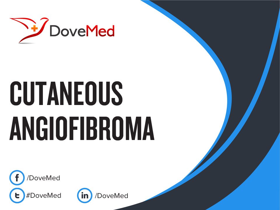 Cutaneous Angiofibroma