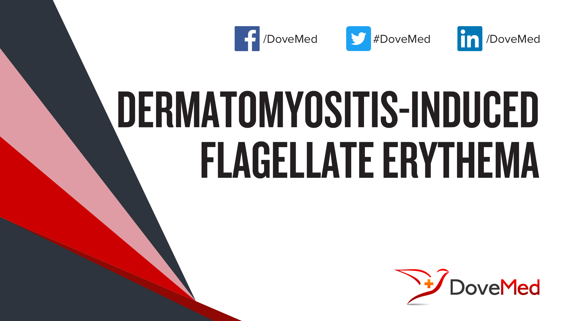 Dermatomyositis-Induced Flagellate Erythema