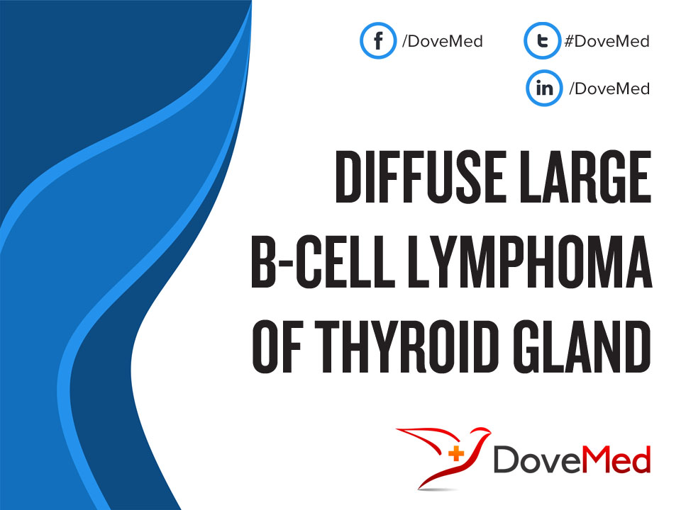 Diffuse Large B-Cell Lymphoma of Thyroid Gland