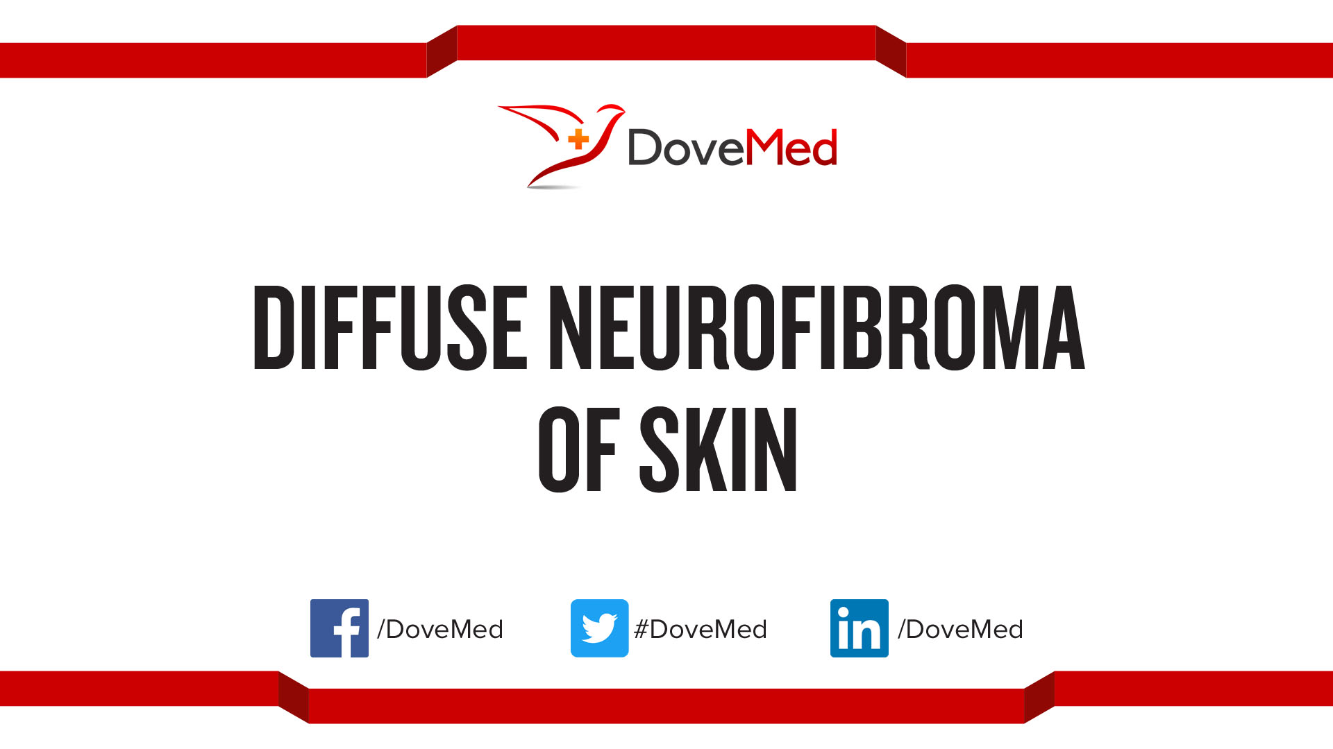 Diffuse Neurofibroma Of Skin