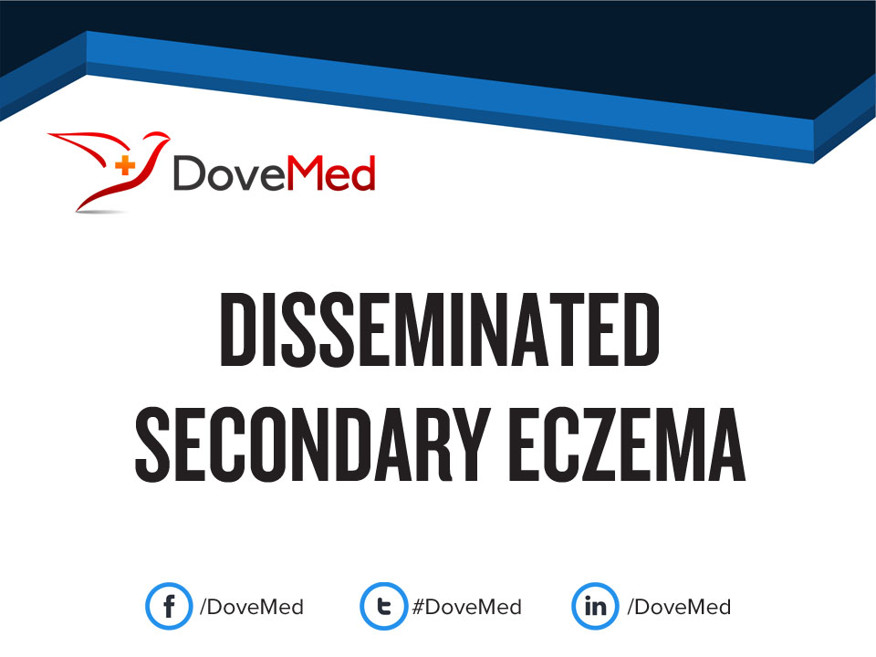 Disseminated Secondary Eczema