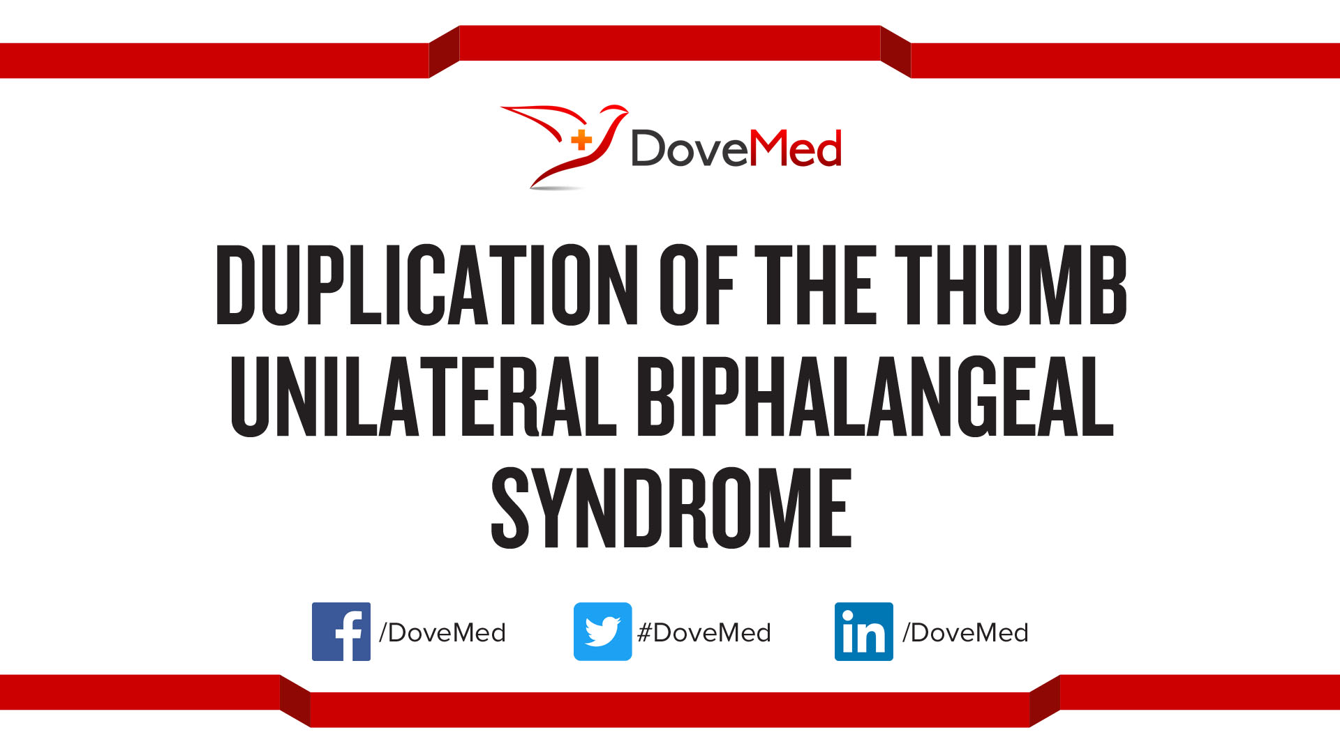 Duplication of the Thumb Unilateral Biphalangeal Syndrome