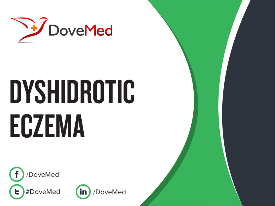 Dyshidrotic Eczema