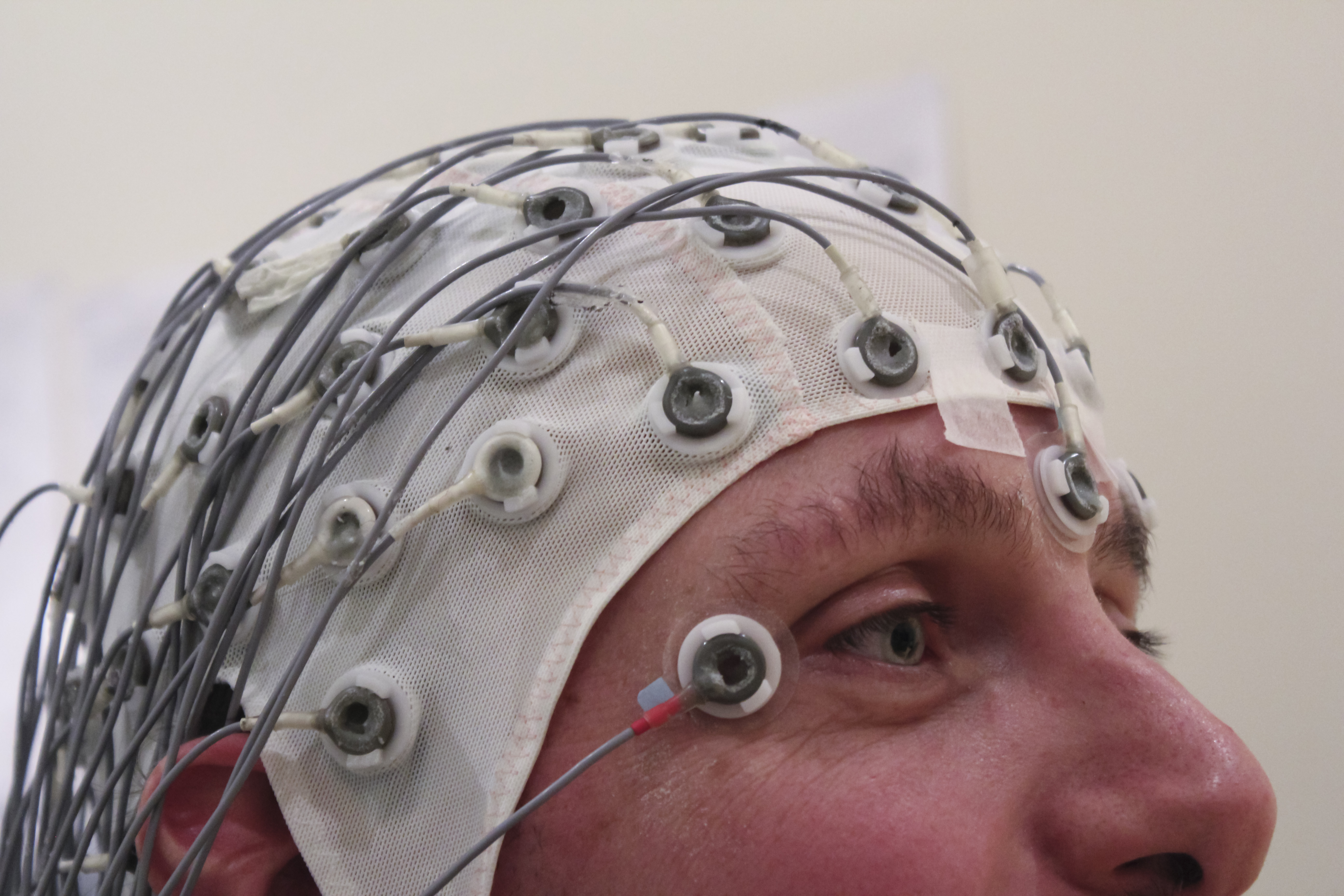 People With Epilepsy Face Increased Risks Of Discrimination And Other ...