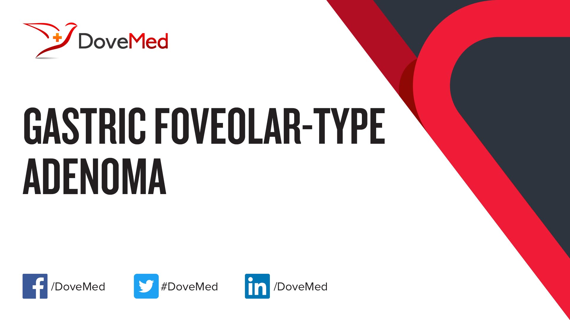 Gastric Foveolar-type Adenoma