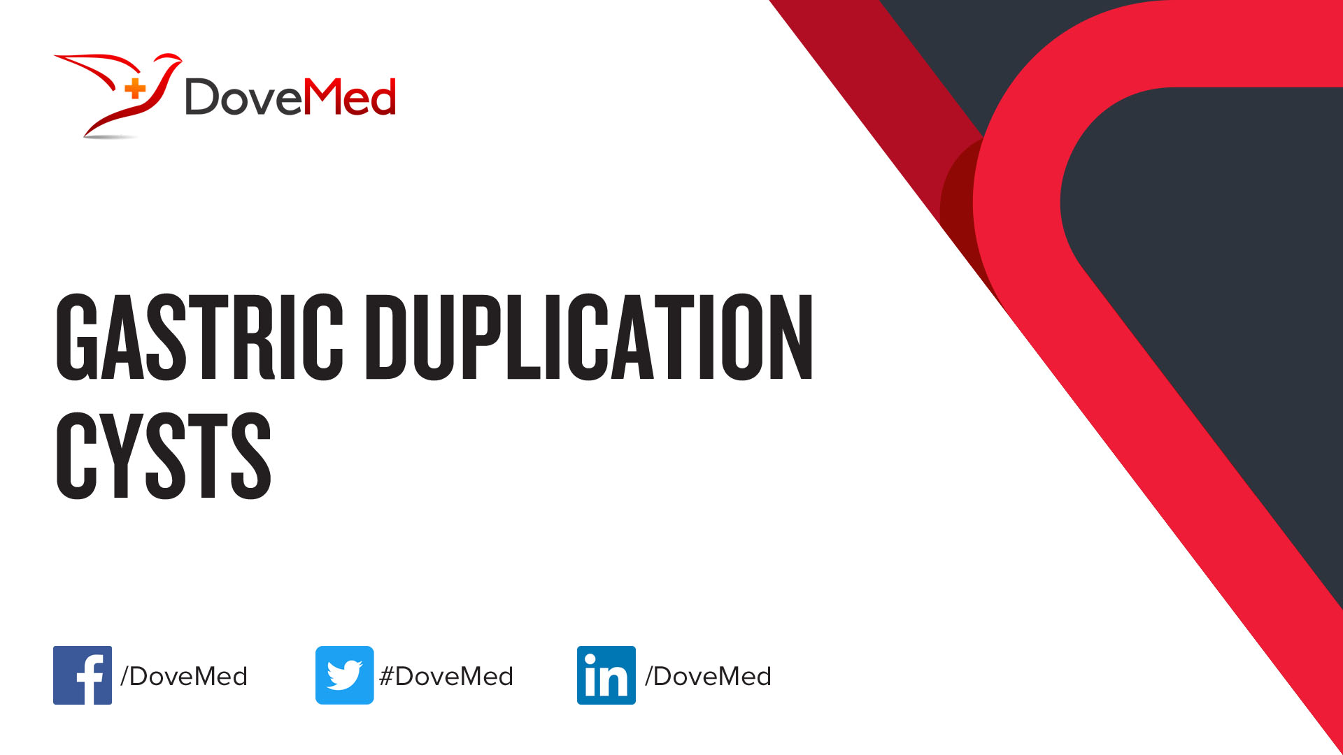Gastric Duplication Cyst